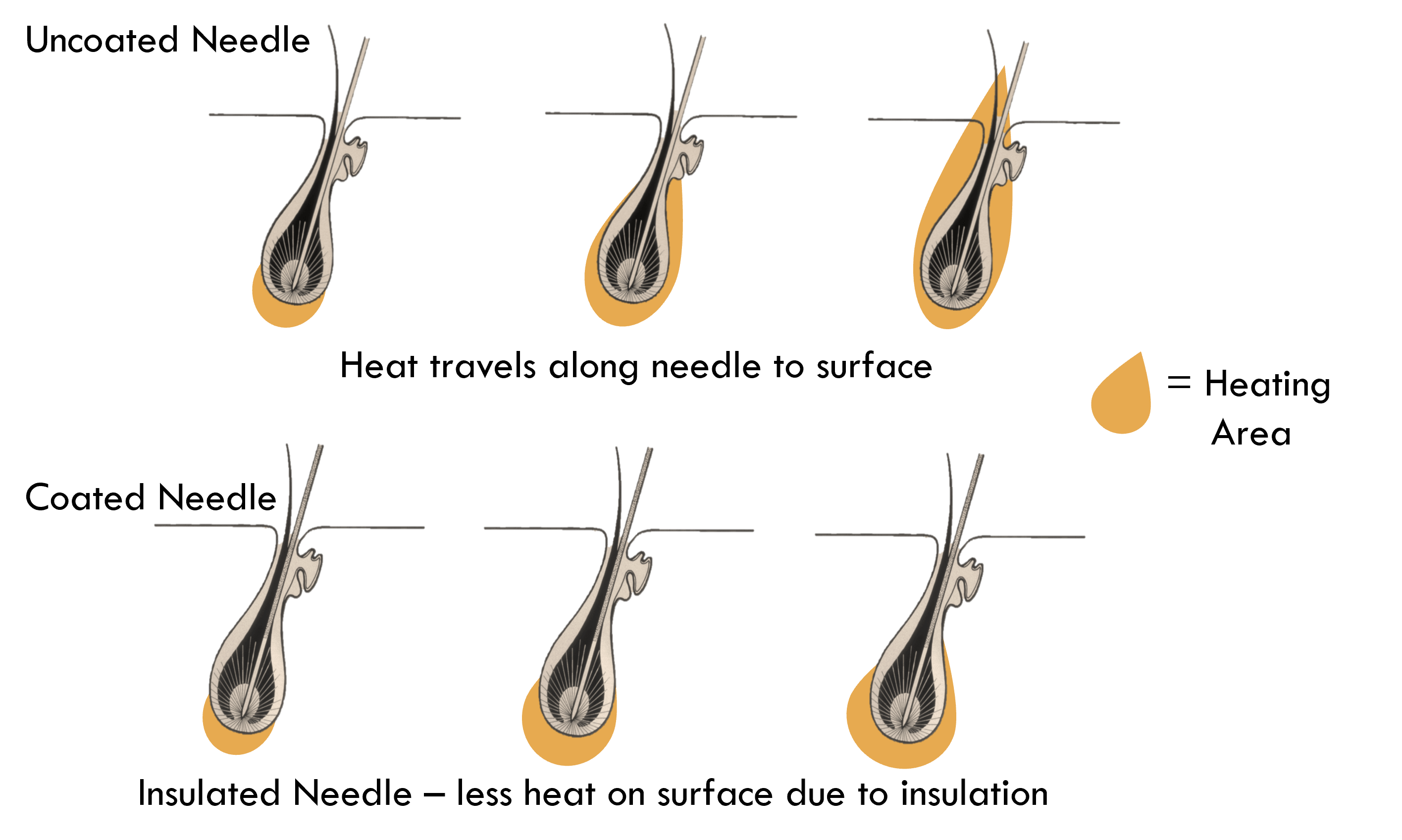 Insulated Needles – A Primer – Synoptic Products